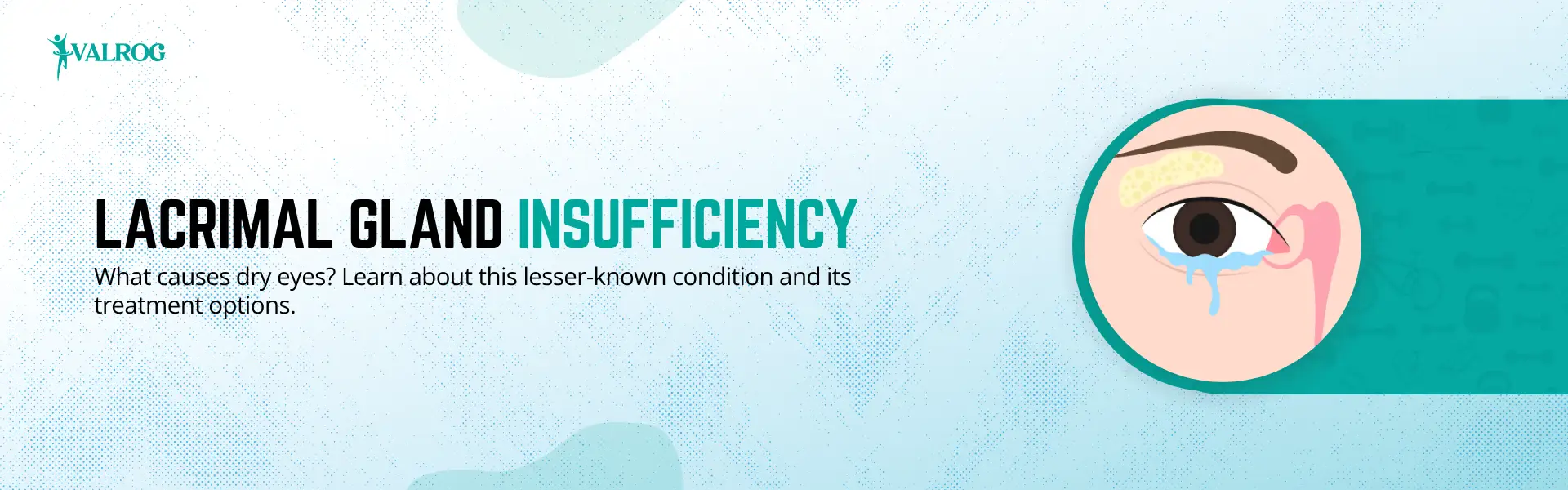 Lacrimal Caruncle & Swollen Gland: Causes & Care